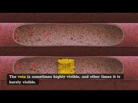 Deveining Shrimp 101: 4 Key Things You Should Know